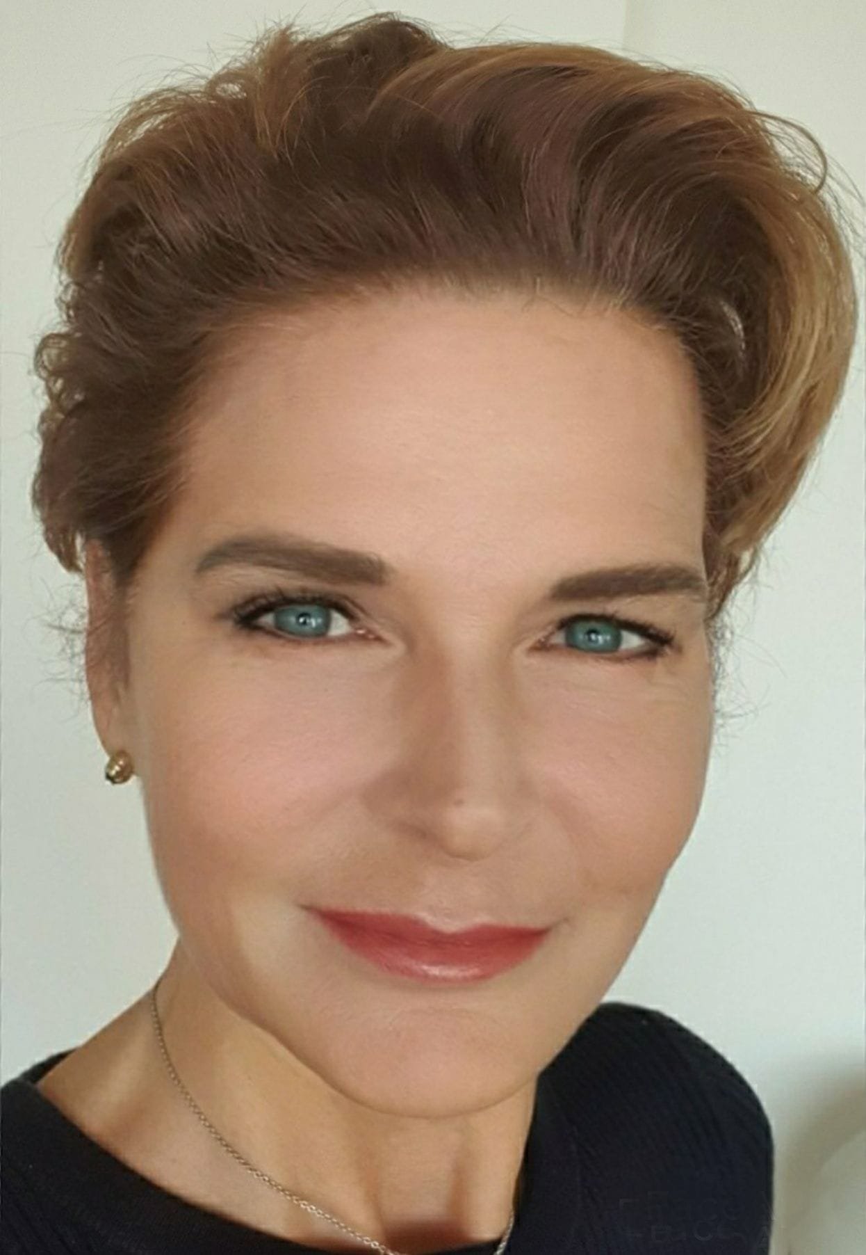 Hyaluron Nebenwirkungen - Ästhetik First Lounge